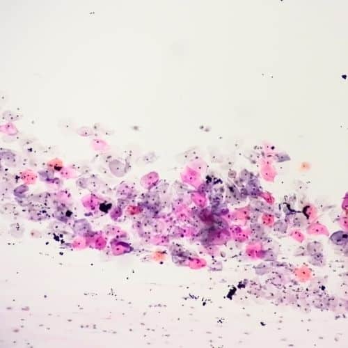 Relational Living with the Smalls: Adventures in Microanimism